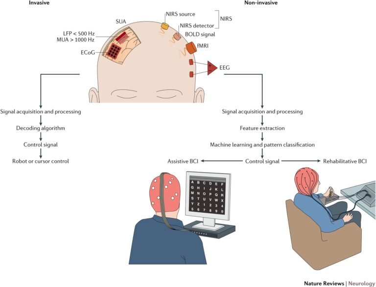 Brain–Computer Interfaces Explained
